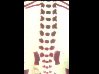 DevTox.Nomenclature: Rat - Lumbar centrum - Hemicentric